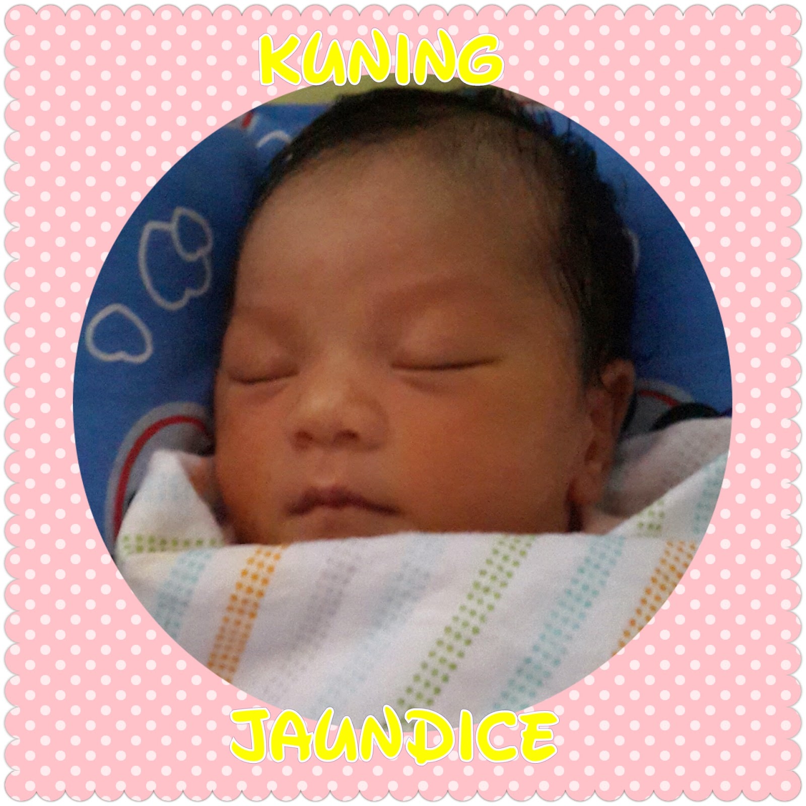 cute Ummi: Baby saya kene kuning (jaundice)